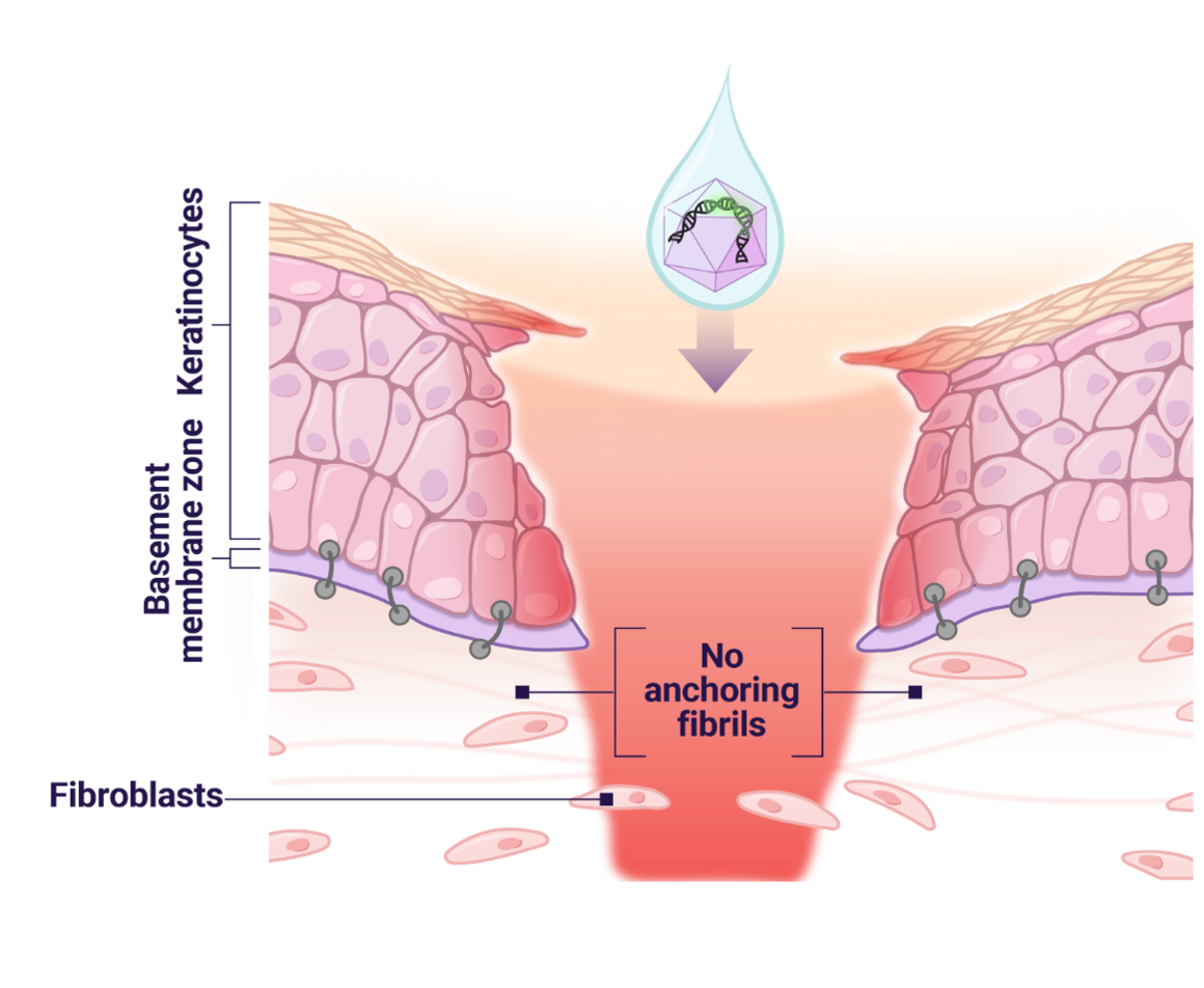 MOA of VYJUVEK® (beremagene geperpavec-svdt) | For HCPs